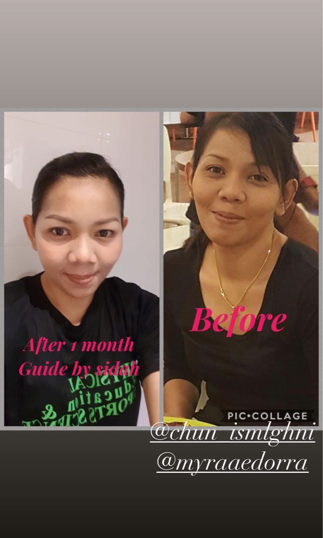 VSL BEAUTY CARE, Beauty & Personal Care, Face, Face Care on Carousell