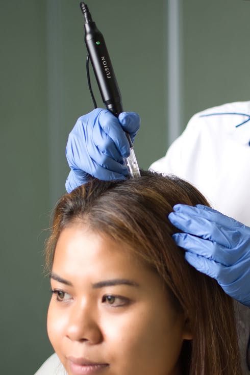 Laser+ micro needle hair growth essence therapy facial thickening grow ...