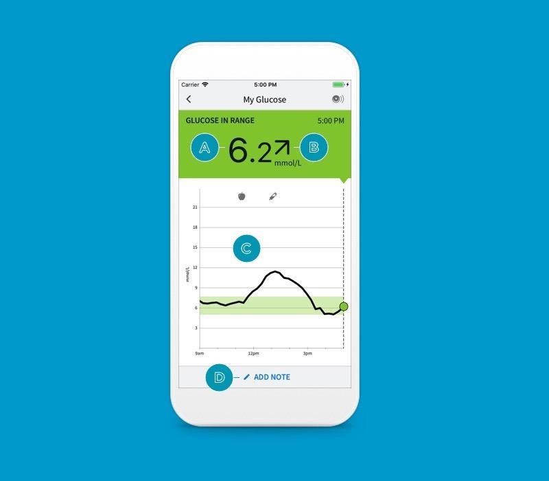 Latest Abbott FreeStyle Libre Sensor Glucose Monitor Free Style Libra ...