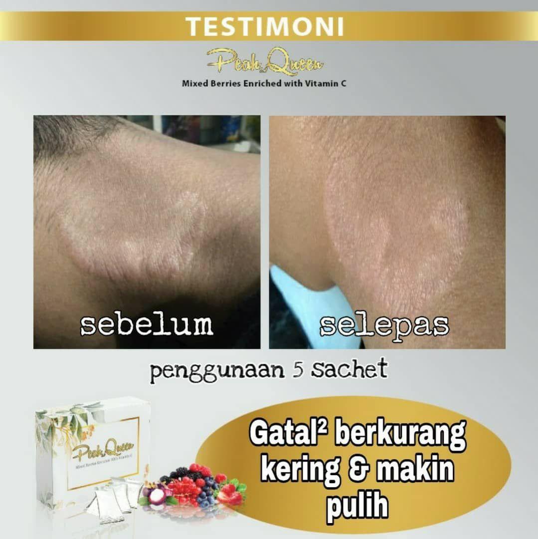 Peah Queen Supplement, Health & Nutrition, Health Supplements, Health ...