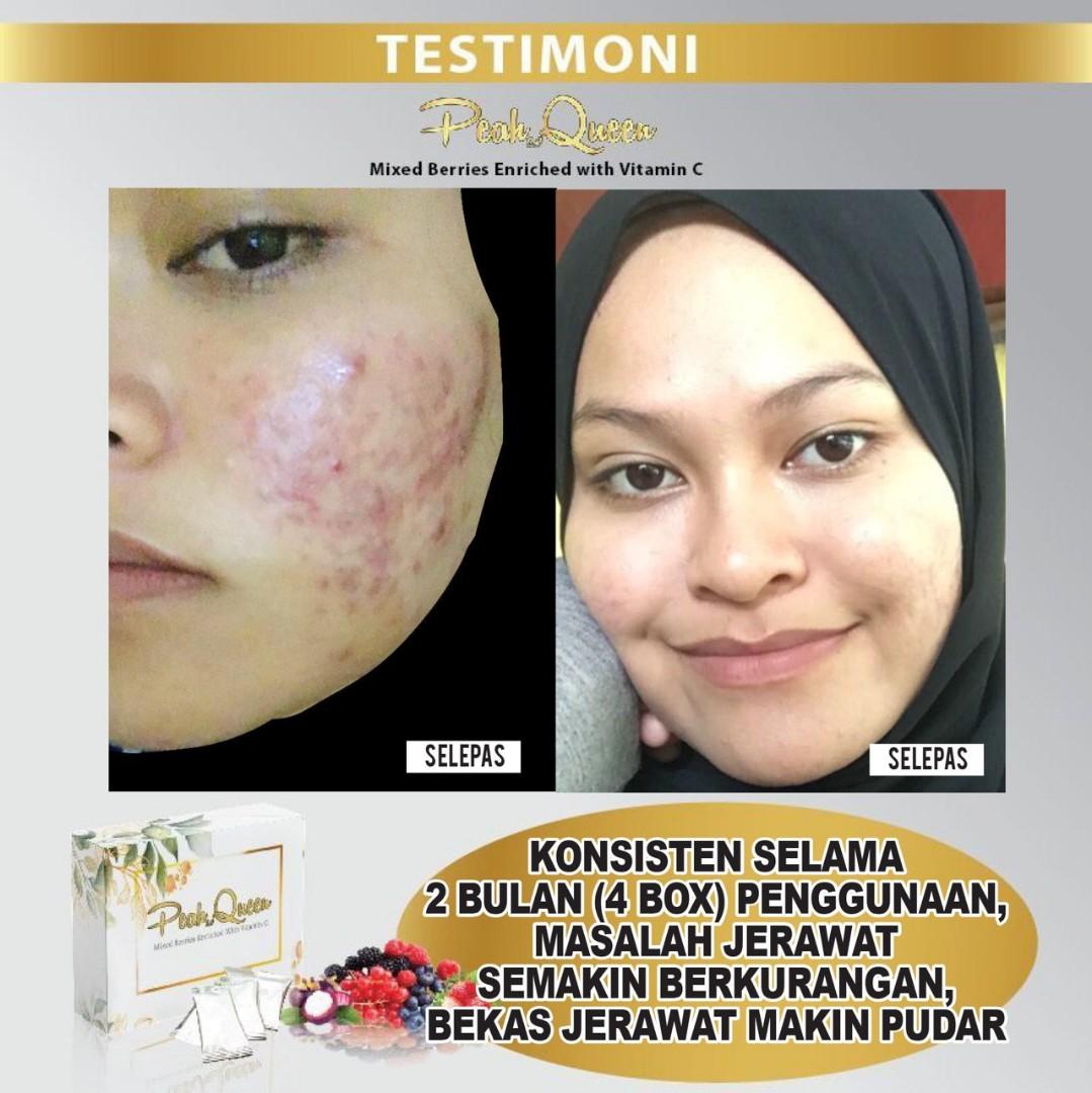 Peah Queen Supplement, Health & Nutrition, Health Supplements, Health ...