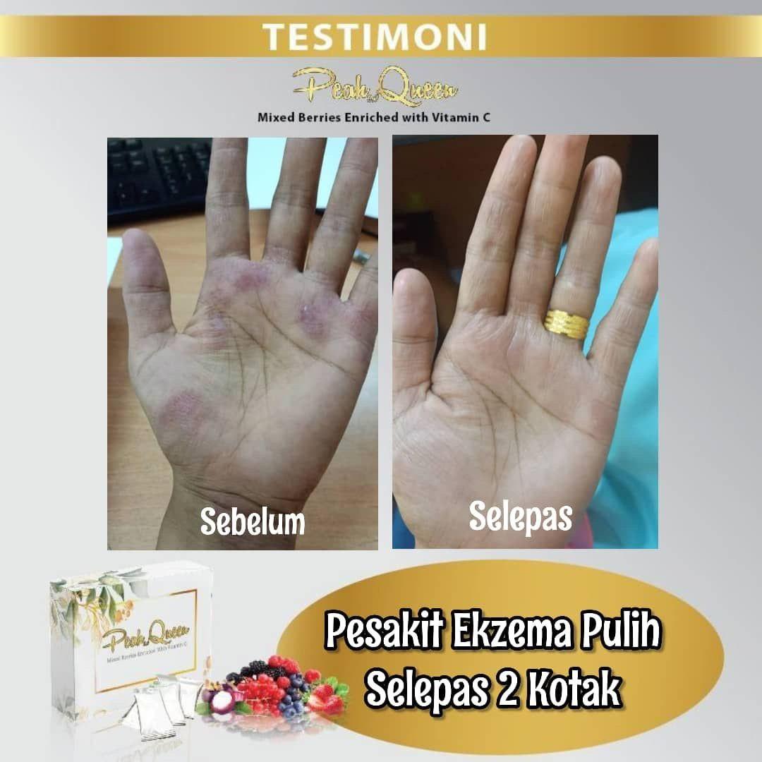 Peah Queen Supplement, Health & Nutrition, Health Supplements, Health ...