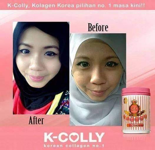 KCOLLY COLLAGEN / KOREAN COLLAGEN / JAMU COLLAGEN, Health & Nutrition ...