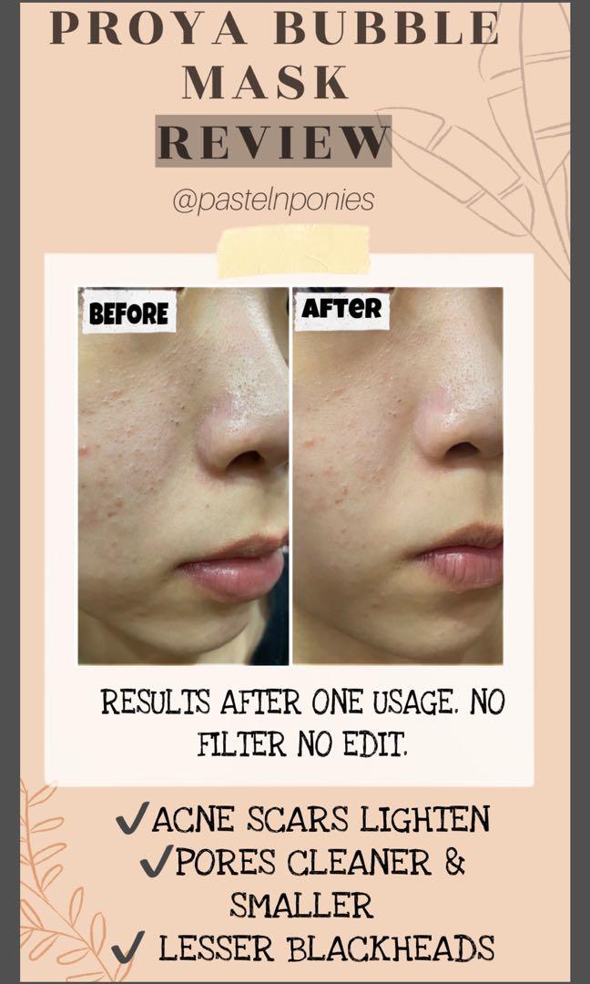 PROYA BUBBLE MASK, Beauty & Personal Care, Face, Face Care on Carousell