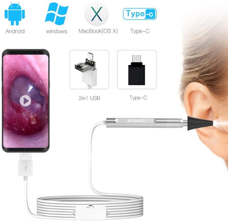 FreeDelivery USB Otoscope-Ear Scope Camera, Anykit New Upgraded 4.3mm ...
