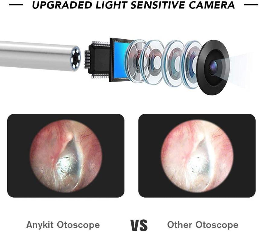 FreeDelivery USB Otoscope-Ear Scope Camera, Anykit New Upgraded 4.3mm ...