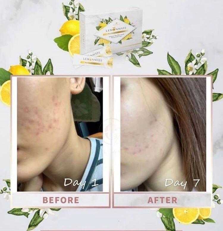 Lemonmate Detox Drink, Food & Drinks, Beverages on Carousell