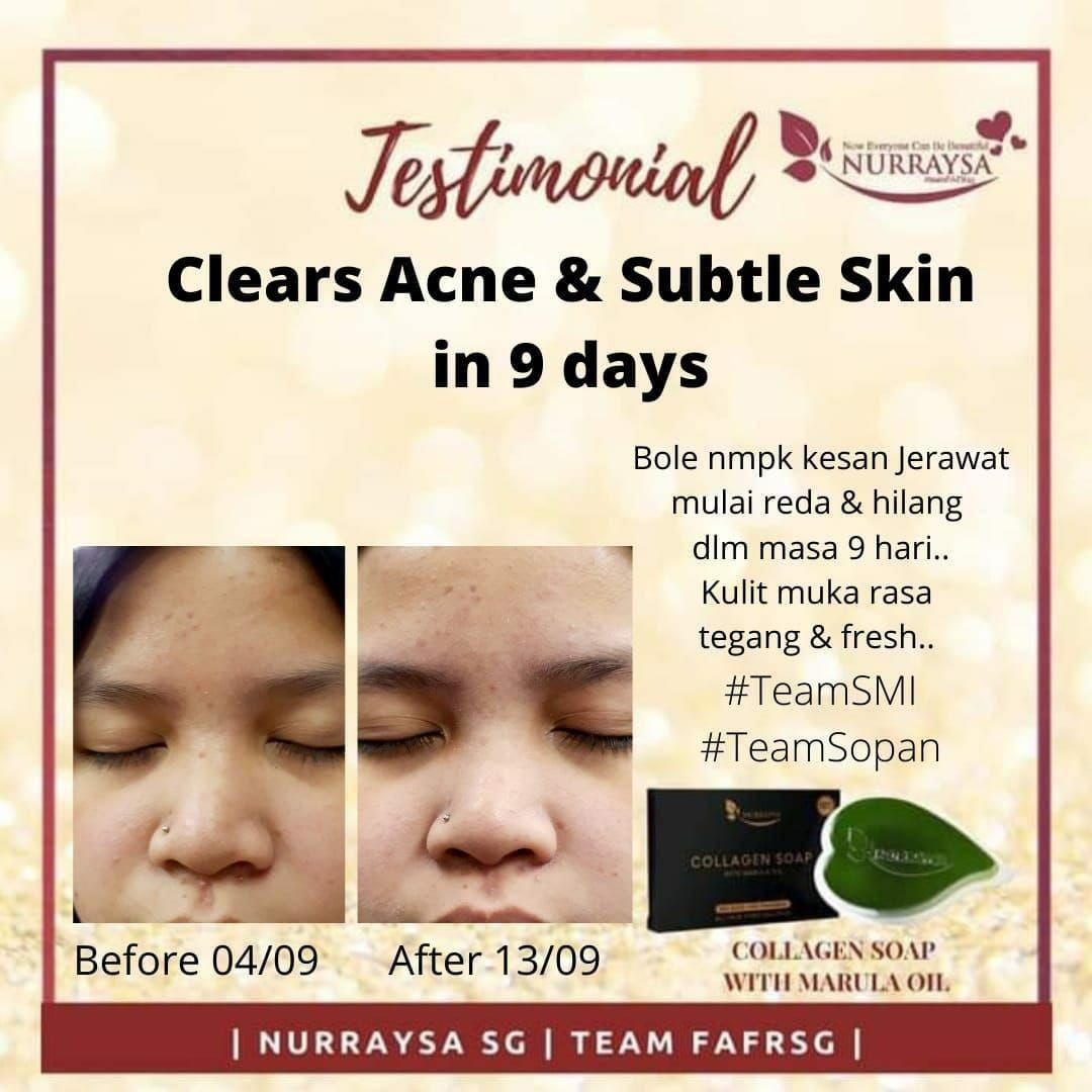 Collagen Soap with Marula Oil, Beauty & Personal Care, Bath & Body ...