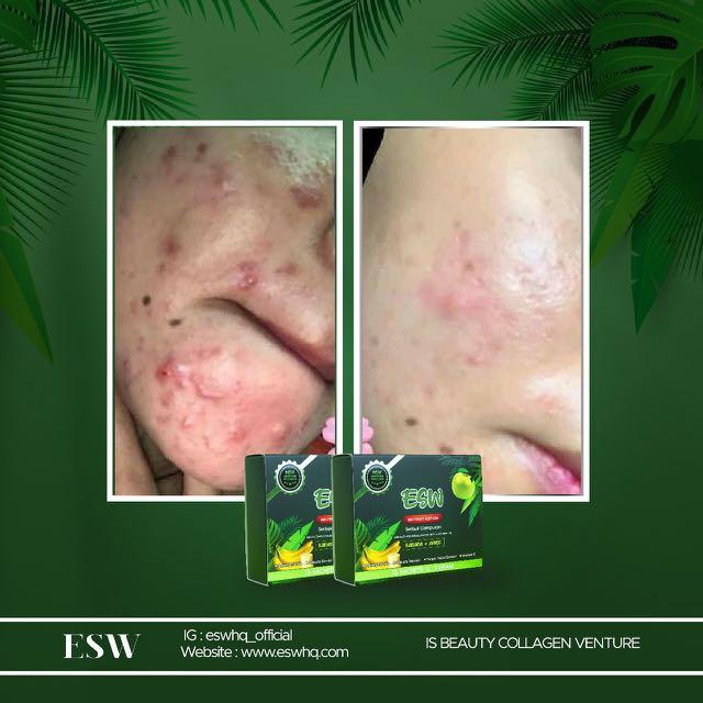 ESW Extra Skin White, Health & Nutrition, Health Supplements, Vitamins ...