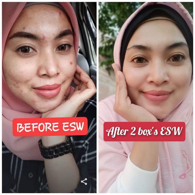 ESW Extra Skin White, Health & Nutrition, Health Supplements, Vitamins ...