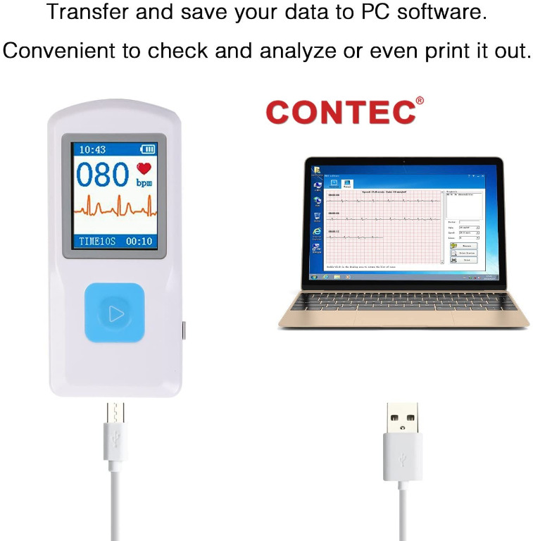 CONTEC Portable ECG/EKG Monitor PC Software Electrocardiogram Bluetooth ...