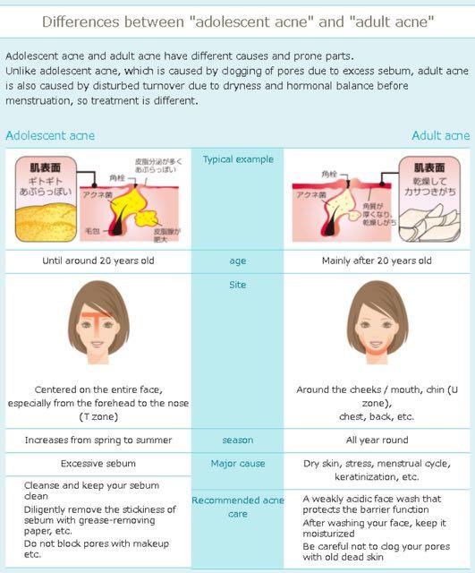 Rohto Mentholatum Acnes 25 Pimple Cream Japan, Beauty & Personal Care ...