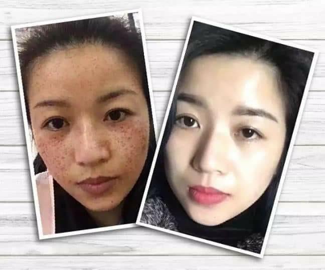 cream for face change white, Beauty & Personal Care, Face, Face Care on ...