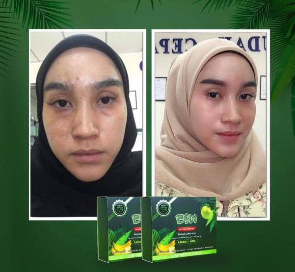 ESW Extra Skin White, Health & Nutrition, Health Supplements, Vitamins ...