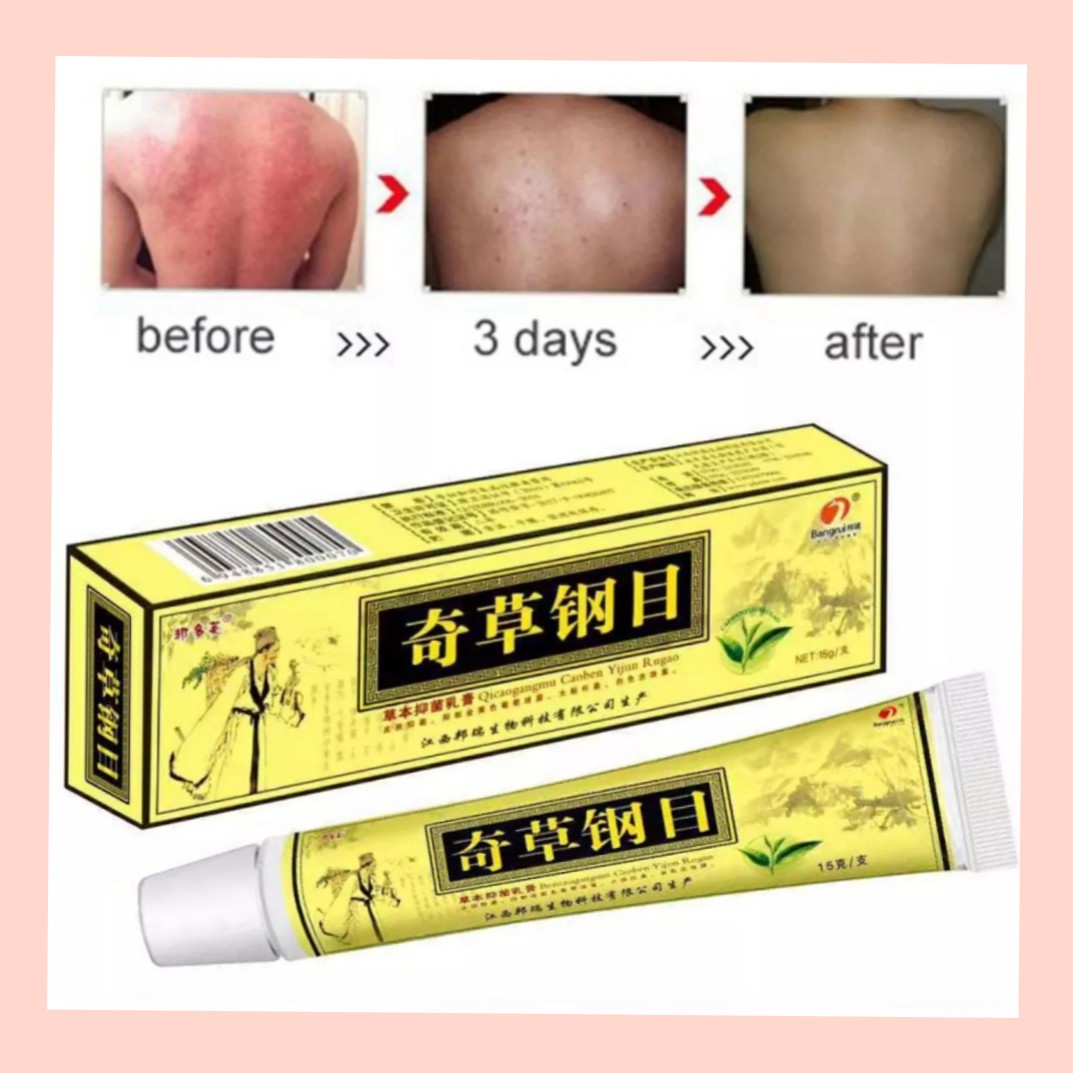 PSORIASIS & ECZEMA NATURAL HERBAL CREAM, Health & Nutrition, Health ...