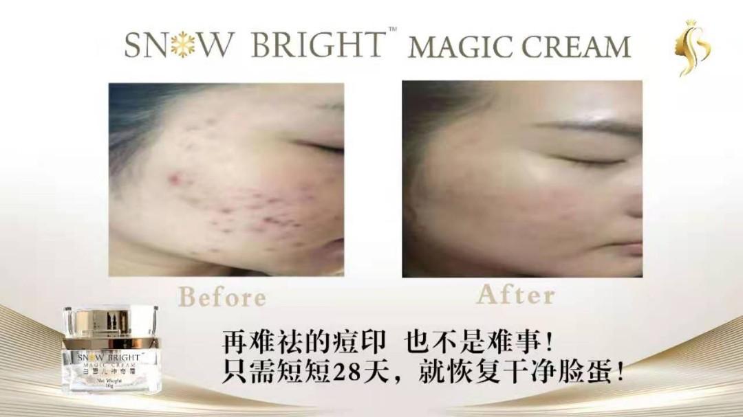 Snow Bright Magic Cream, Beauty & Personal Care, Face, Face Care on ...