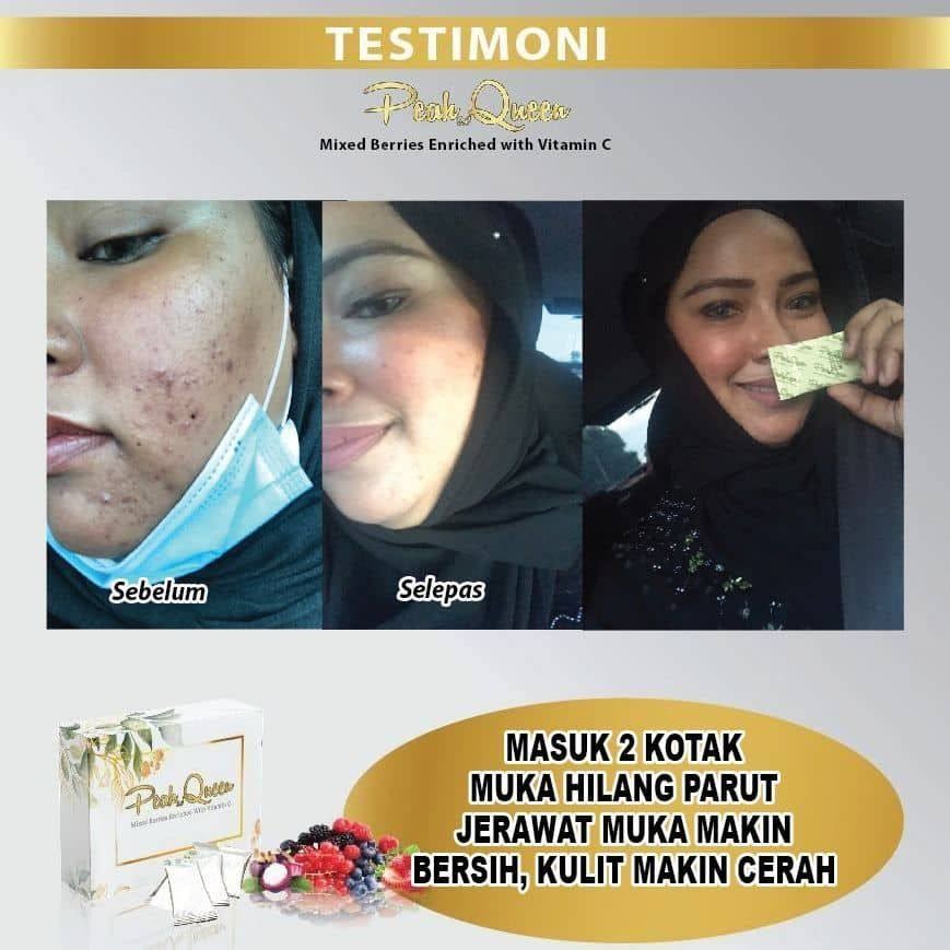 Peah Queen on Carousell