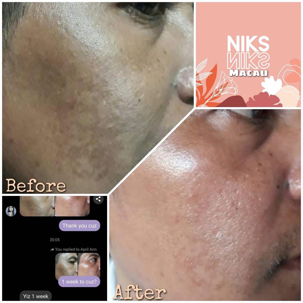 Niks Skin Reveal Set/Nurture Kit/ Lip and Cheek Serum , Beauty ...