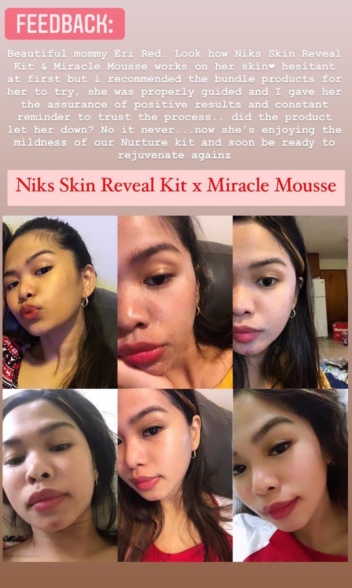 Niks Skin Reveal Set/Nurture Kit/ Lip and Cheek Serum , Beauty ...