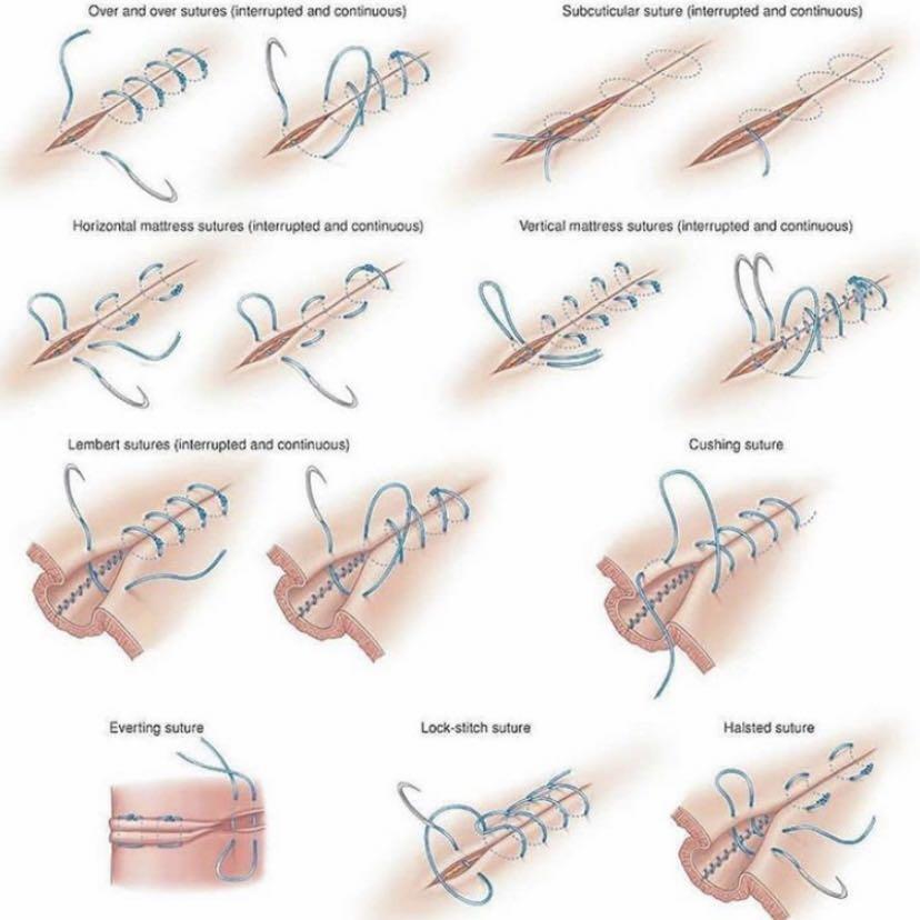 Shoulder Pads (Foam) + Suture / Wound Care pad by Labman, Everything Else on Carousell