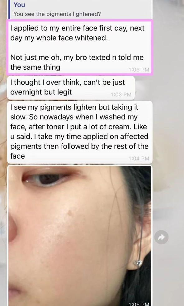 WOUWOU Freckle Cream -whitening/lighten freckle/uneven skin tone ...