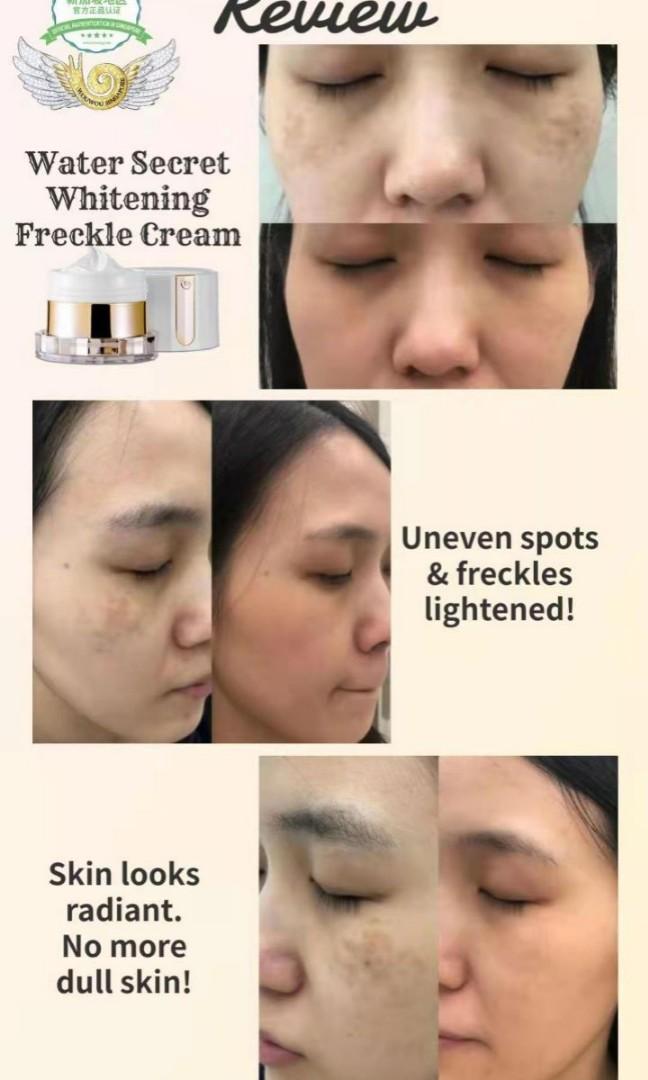 WOUWOU Freckle Cream -whitening/lighten freckle/uneven skin tone ...