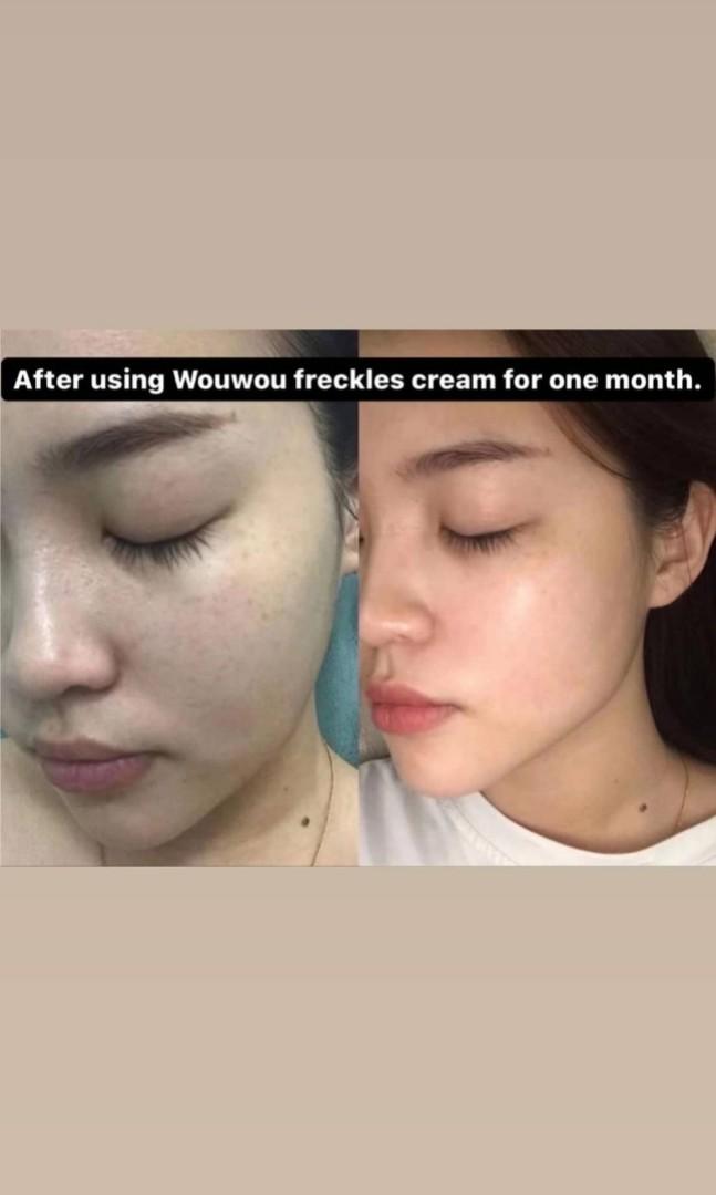 WOUWOU Freckle Cream -whitening/lighten freckle/uneven skin tone ...