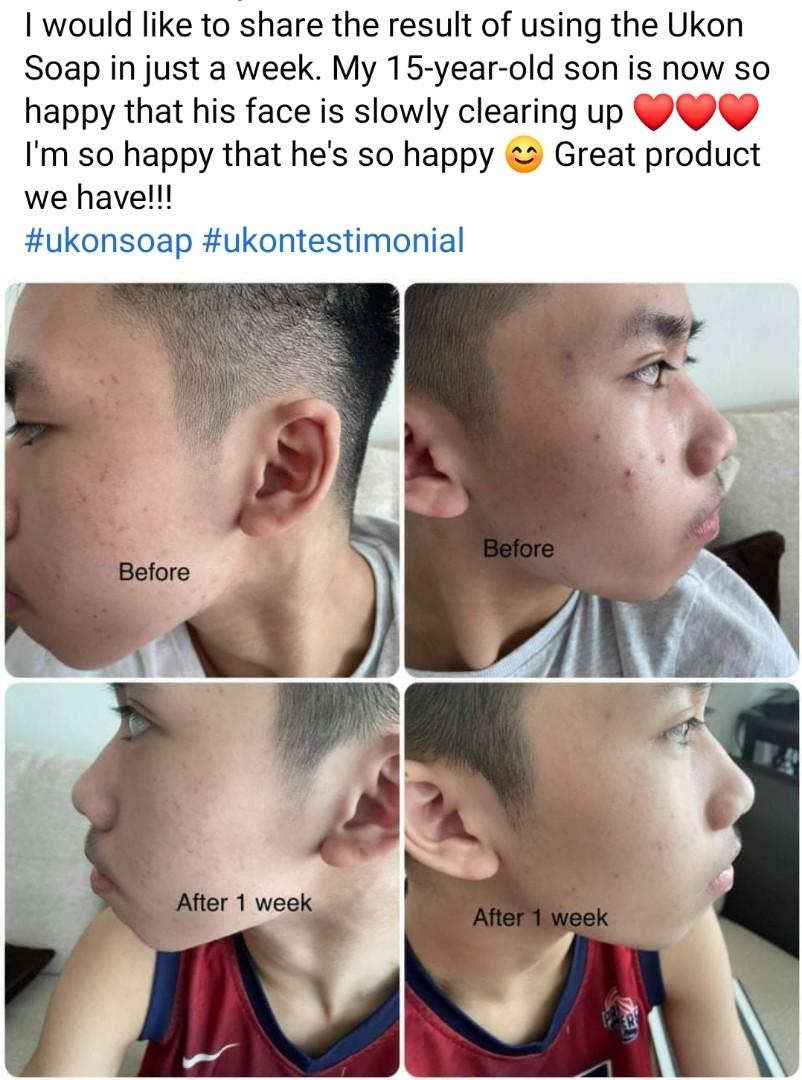 Essential for Beautiful Skin - Enagic Kangen Ukon & Honey Soap (Made in ...