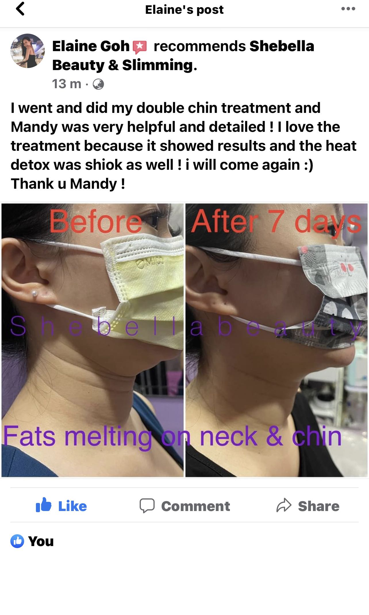 V-Jet fat melting Double Chin ,face slimming , Body slimming FOC full ...