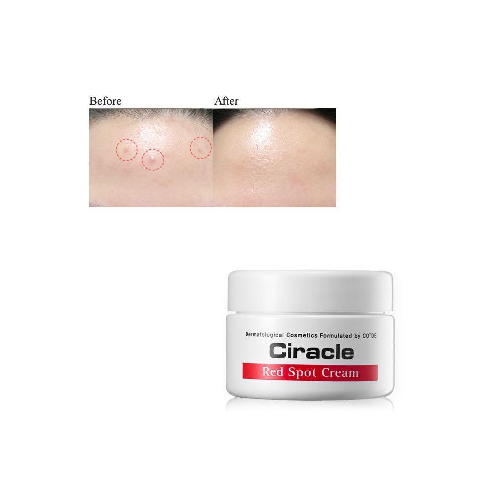 Ciracle red spot cream (30g), Beauty & Personal Care, Face, Face Care ...