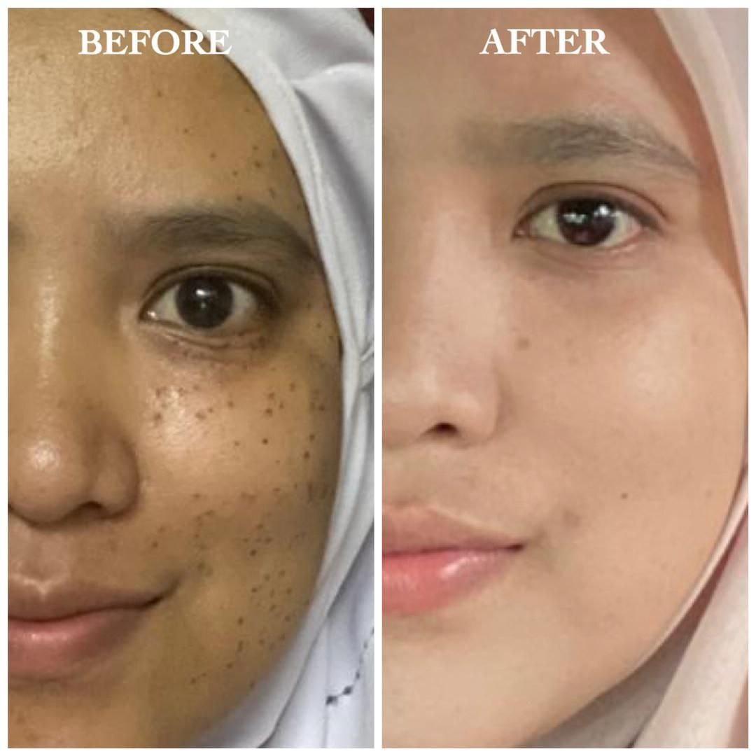 Original Bloom Collagen Young Living Ready Stock, Beauty & Personal ...