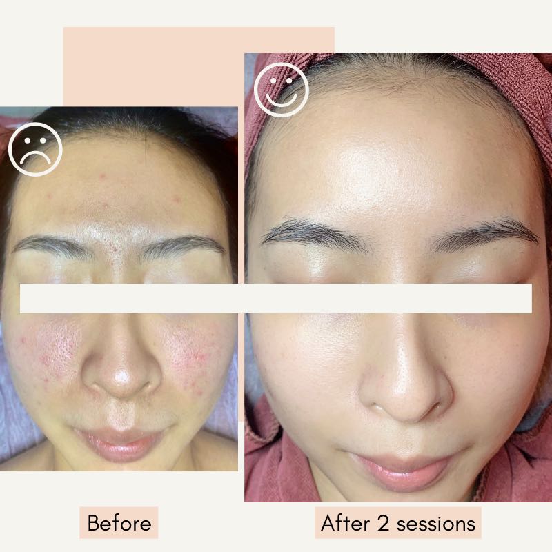 Meridian Bojin Facial + Eye Treatment, Beauty & Personal Care, Face ...