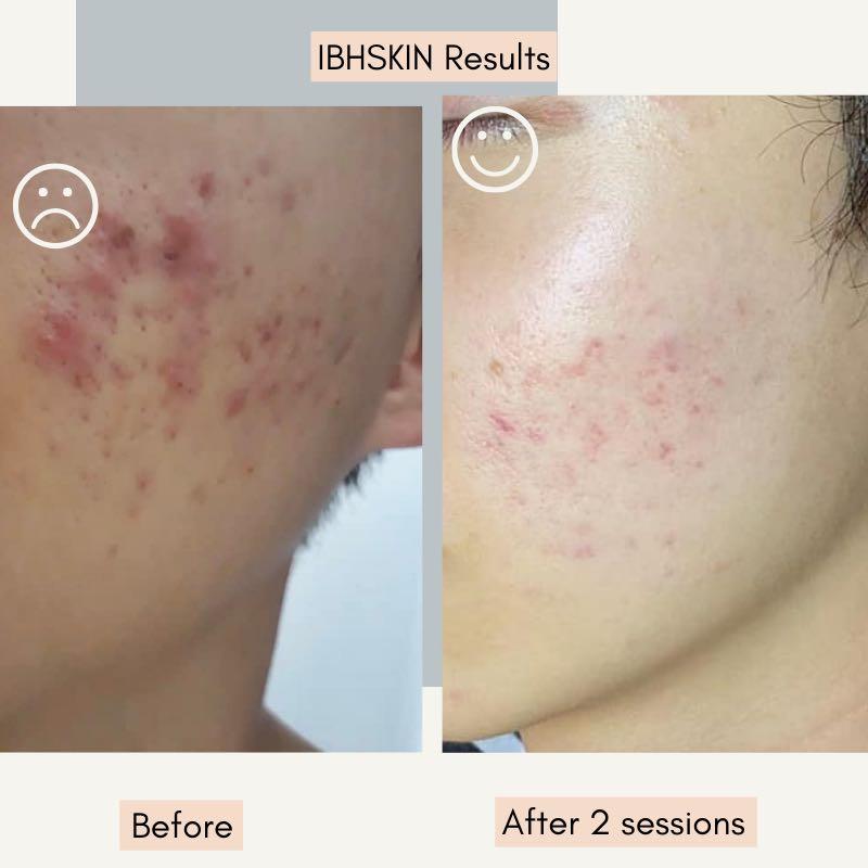 Meridian Bojin Facial + Eye Treatment, Beauty & Personal Care, Face ...