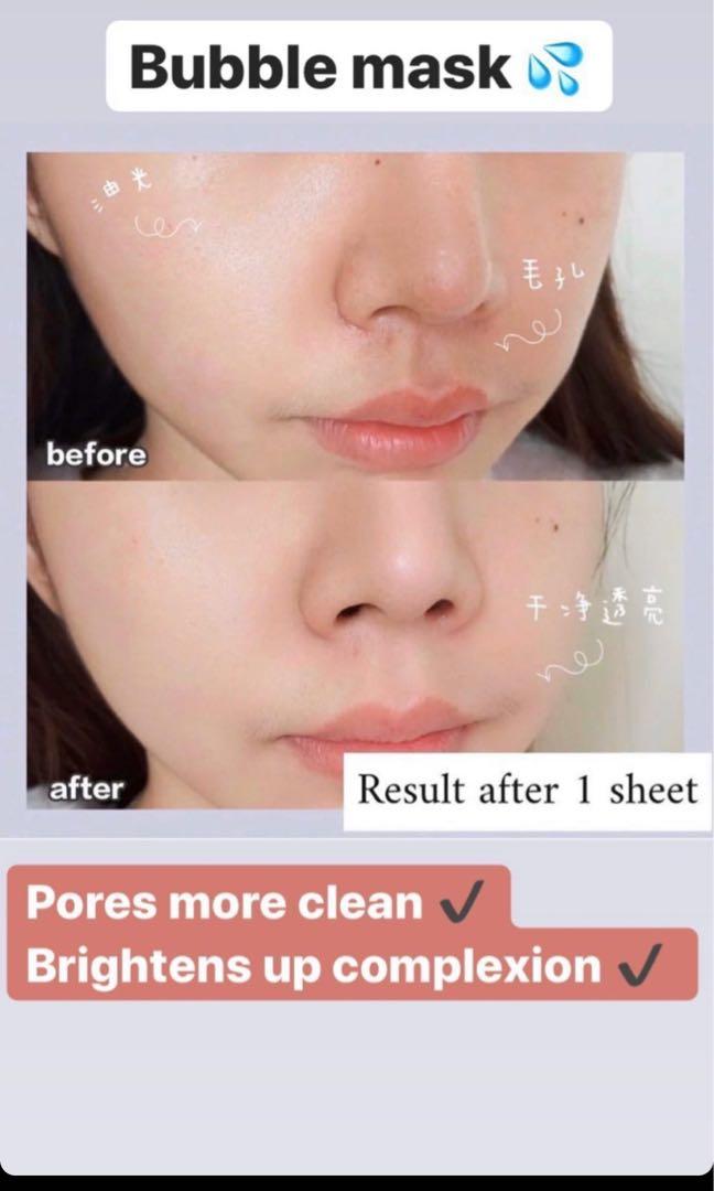 Samanli Bubble Mask, Beauty & Personal Care, Face, Face Care on Carousell