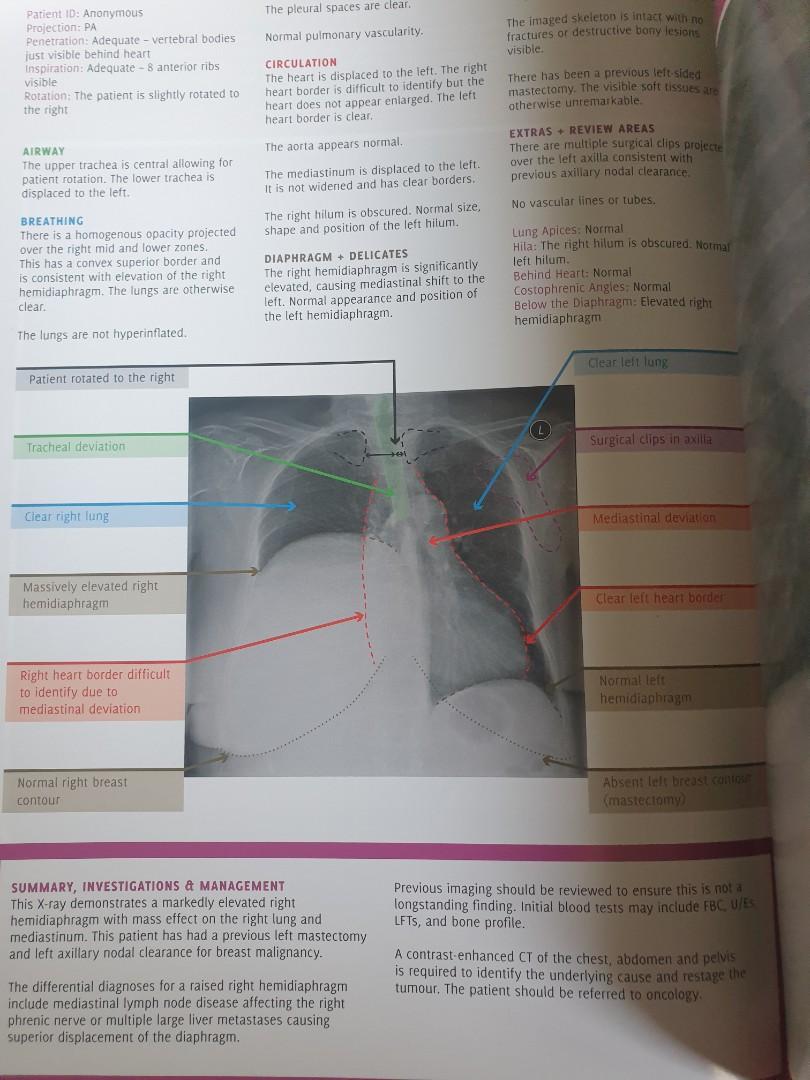 Medical Book: Radiology: 100 Practice Chest X-Rays, Hobbies & Toys ...