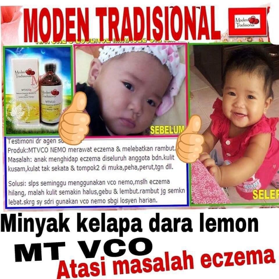 NEMO Oil (VCO) - Thyroid / Dandruff & Itchy / Hairfall/Eczema/Psoriasis ...