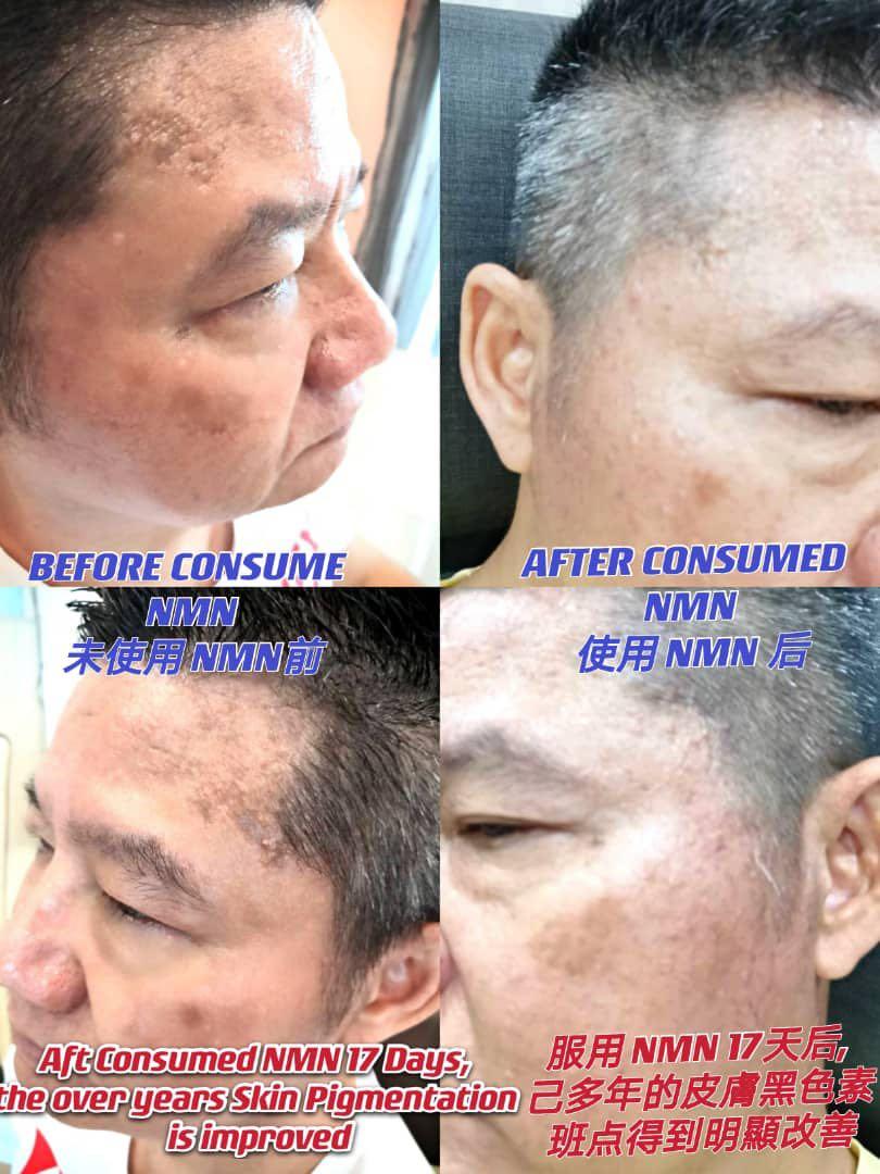 NMN- from USA (5G technology), Health & Nutrition, Health Supplements, Vitamins & Supplements on ...