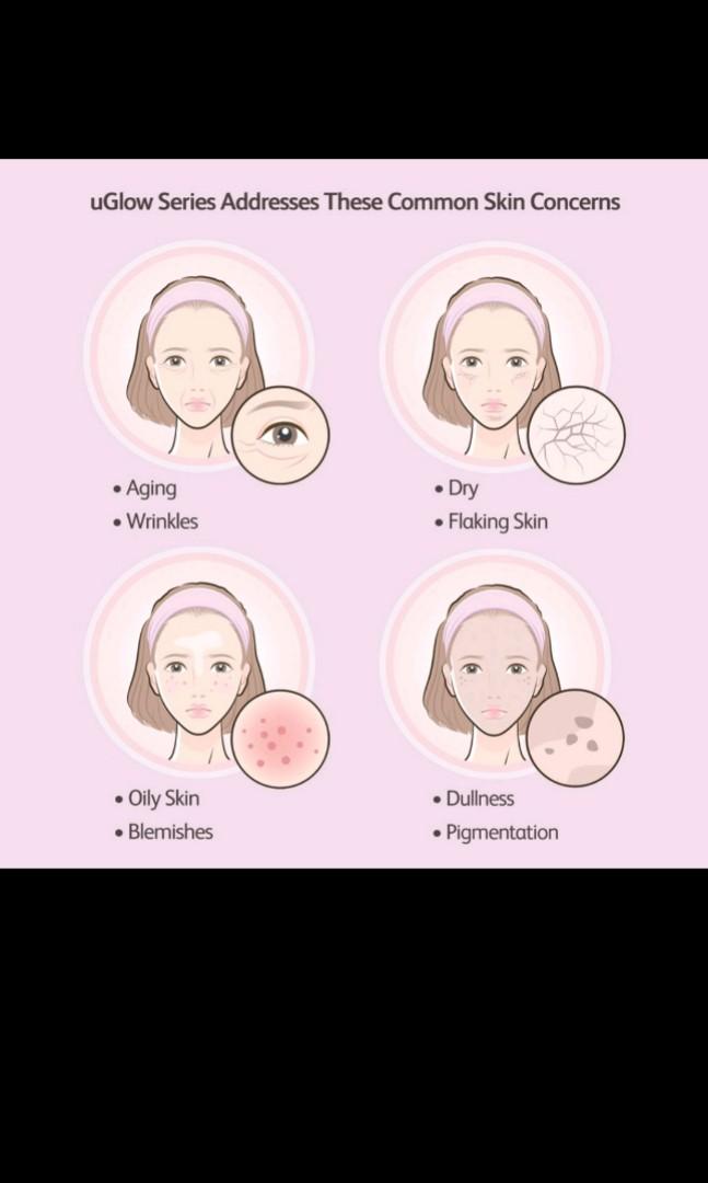 OSIM uGlow Eye, Beauty & Personal Care, Face, Face Care on Carousell