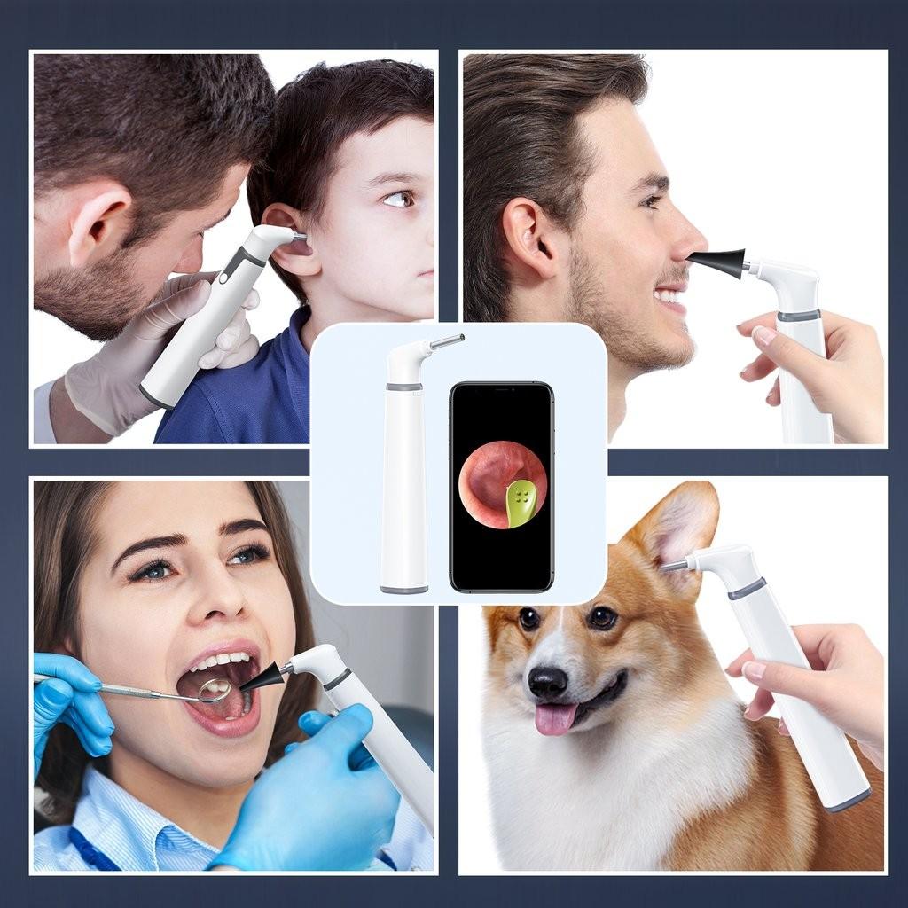 Smart Otoscope with Smart Otoscope App (SA39W), 健康及營養食用品, 醫療用品和工具 ...