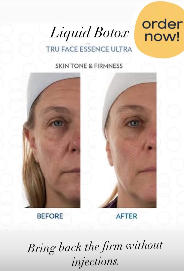 Liquid Botox, Beauty & Personal Care, Face, Face Care on Carousell