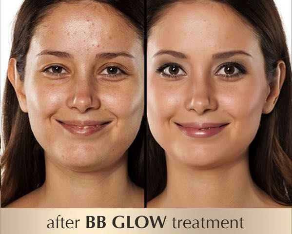 Korean BB GLOW Facial treatment , Beauty & Personal Care, Face, Face ...
