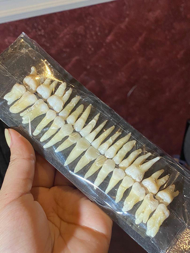 Tooth Specimen (Dental Study Model), Hobbies & Toys, Stationary & Craft ...