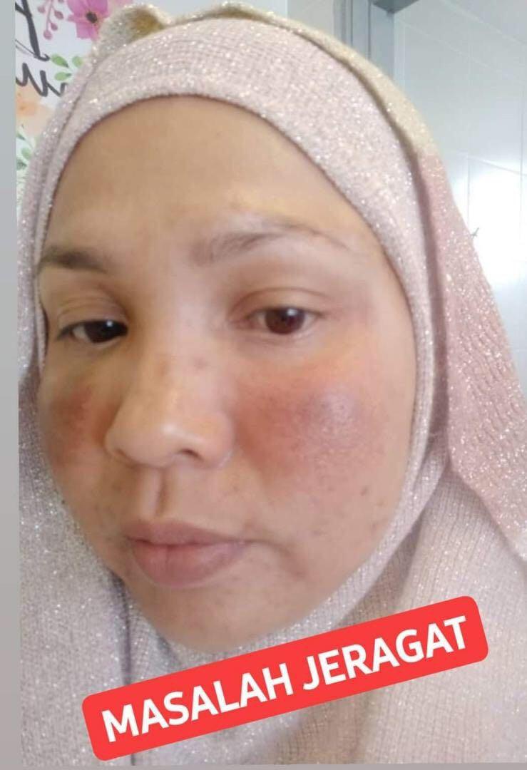 ESW Activ White New Formulation, Health & Nutrition, Health Supplements ...