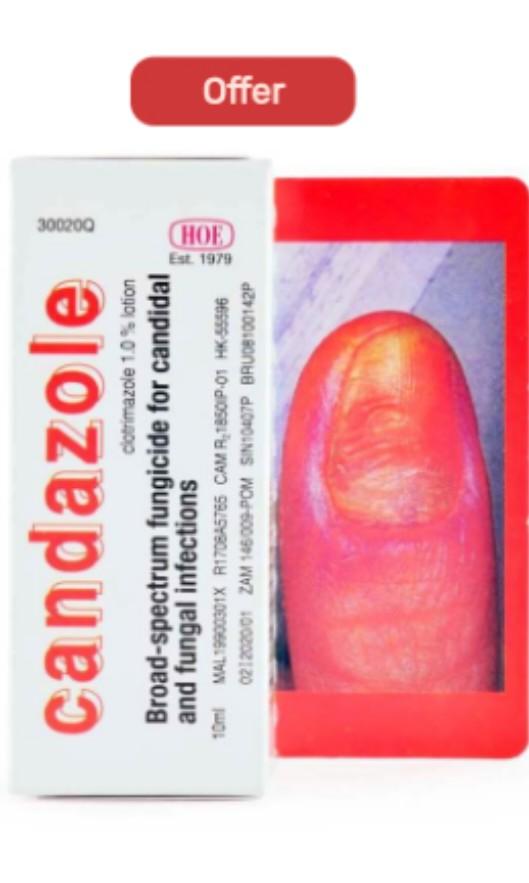 Candazole anti-fungal lotion, Health & Nutrition, Medical Supplies ...