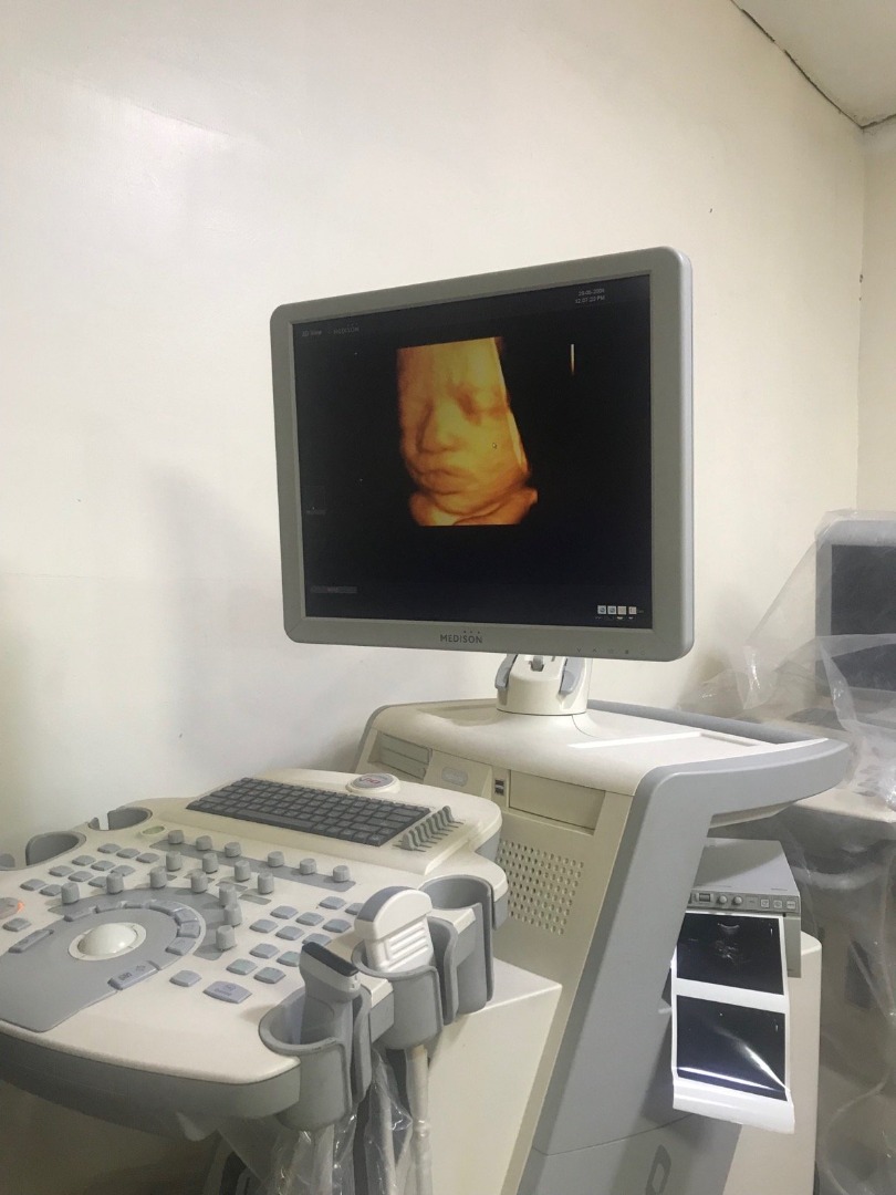 For Sale: Ultrasound Samsung Medison Accuvix V10 with 3 probes covex ...