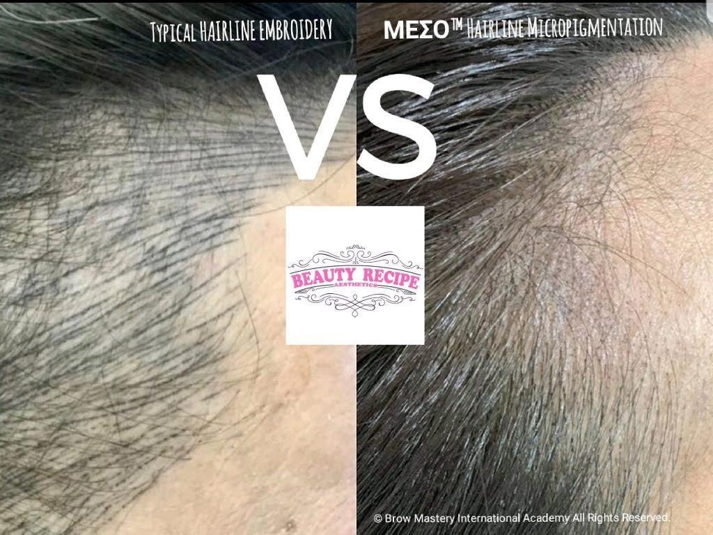 Beauty Recipe Scalp Micropigmentation & Hair tattoo (Male and/or Female ...