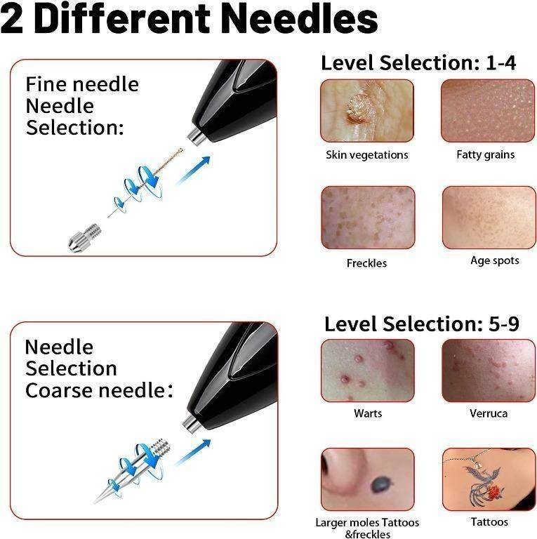 [1089] Beauty Skin Tags Remover Pen, Portable Rechargeable Mole Remover ...