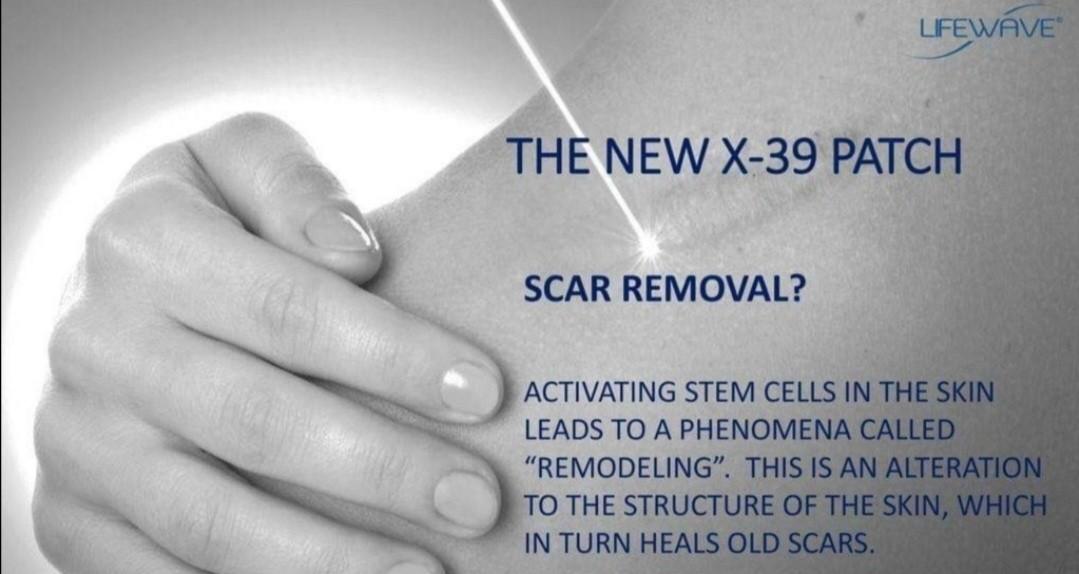 LIFEWAVE X39 PHOTOTHERAPHY STEM CELL PATCH x 30 PATCHES, Beauty ...