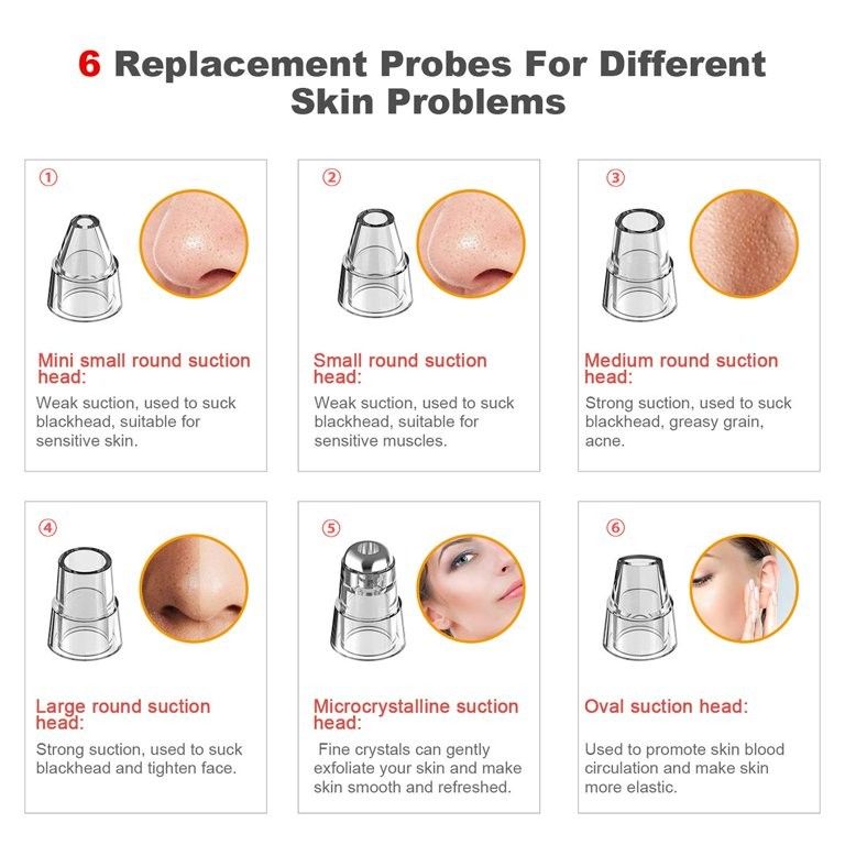 Alupper Blackhead Remover Vacuum, Suction Tool, Pimple Sucker with ...