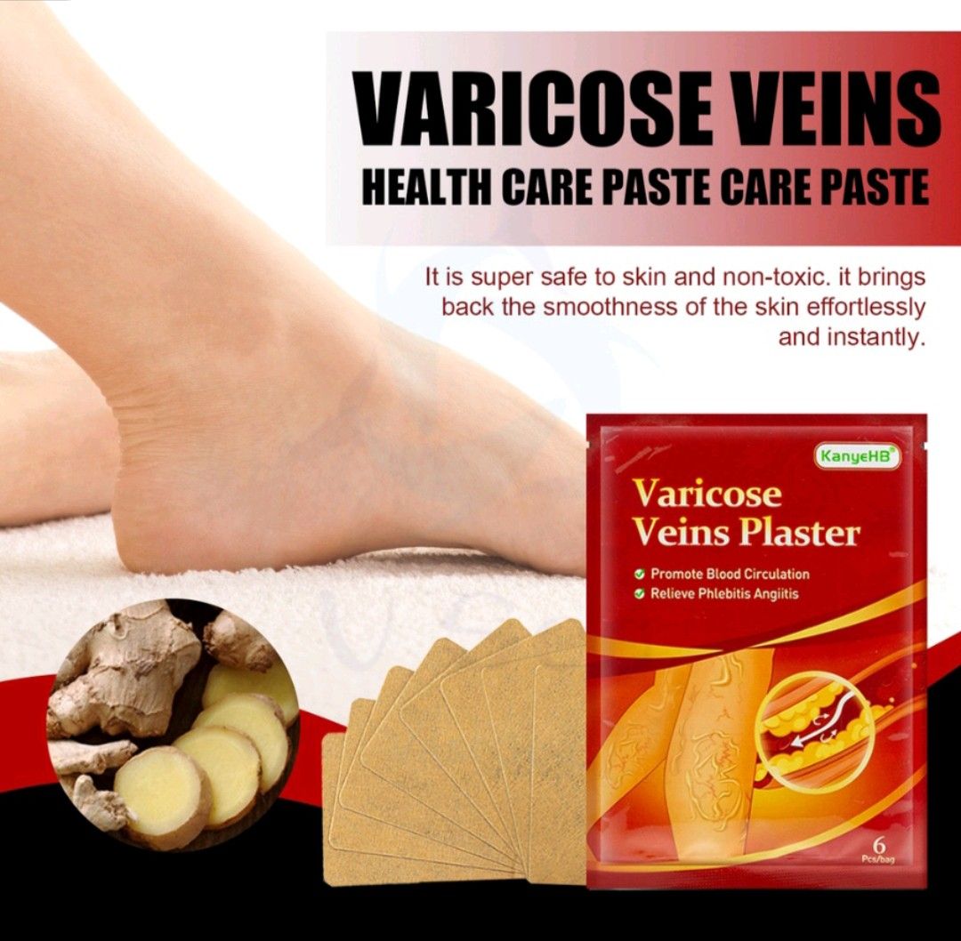 Varicose Veins Plaster, Beauty & Personal Care, Foot Care on Carousell